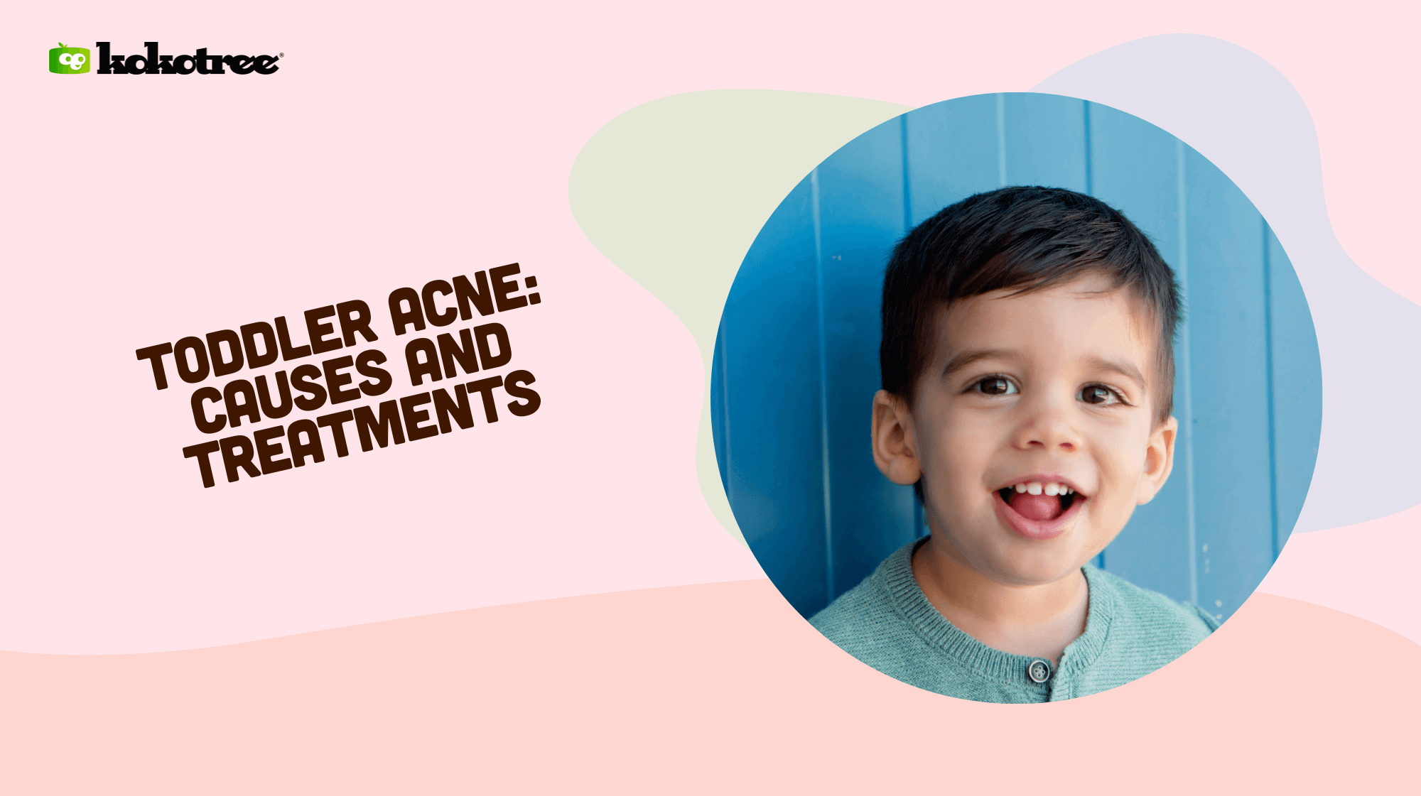 Toddler Acne: Causes and Treatments - Kokotree